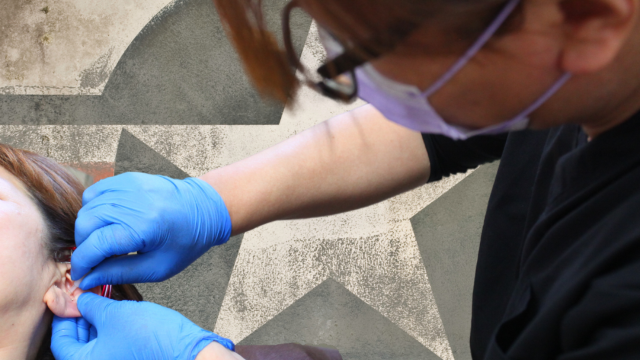 戦場鍼（Battlefield Acupuncture・BFA）とは | BFA JAPAN｜戦場鍼ハンズオンセミナー